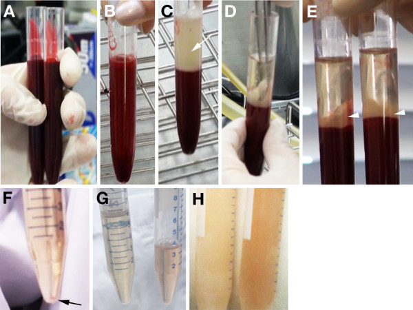 Preparation of Rat Serum Suitable for Mammalian Whole Embryo Culture