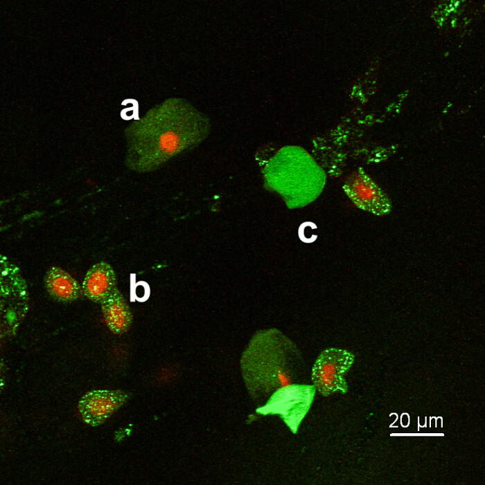 Impression Cytology of the Lid Wiper Area