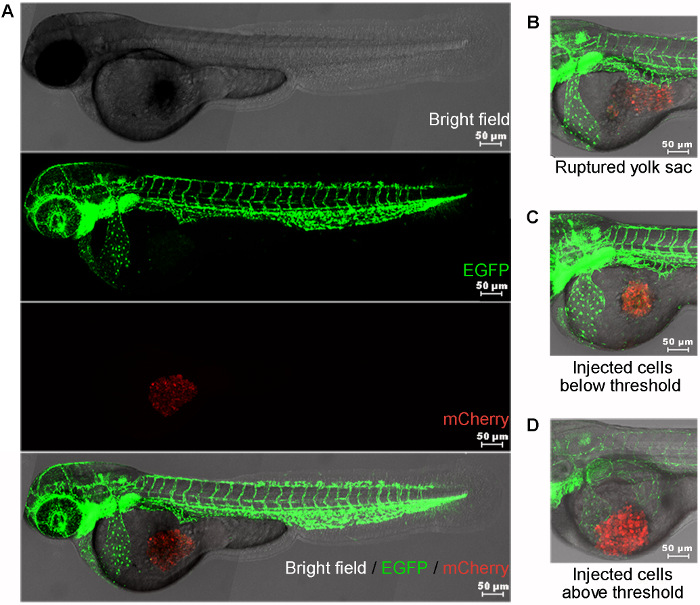 Invasive Behavior of Human Breast Cancer Cells in Embryonic Zebrafish