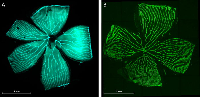 Studying Diabetes Through the Eyes of a Fish: Microdissection ...