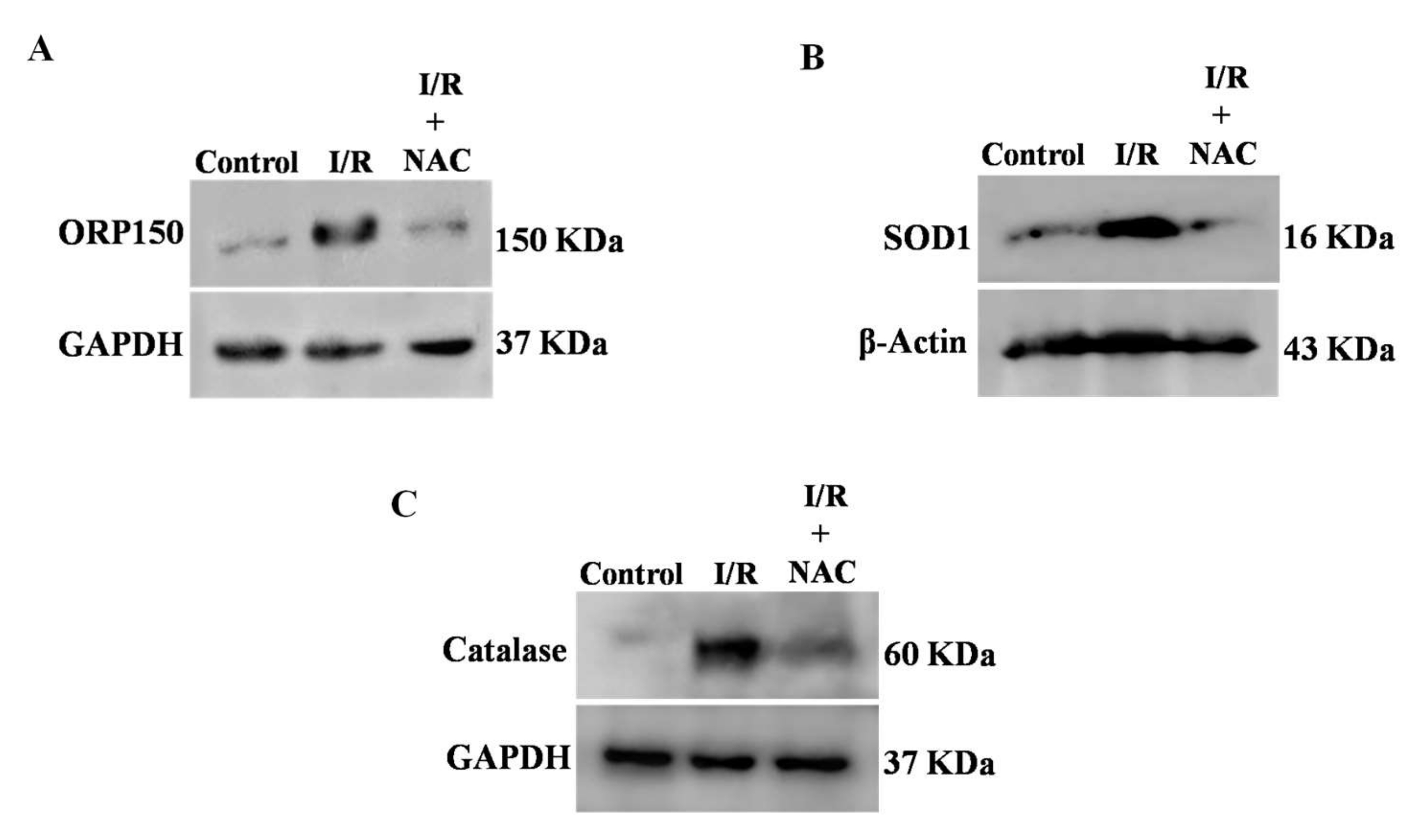Generation of Hook Ischemia-Reperfusion Model using a Three-Day ...