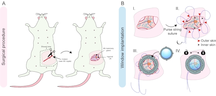 Longitudinal Intravital Microscopy Using a Mammary Imaging Window with ...