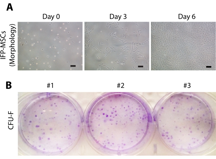 Isolation, Expansion, and Differentiation of Mesenchymal Stem Cells ...