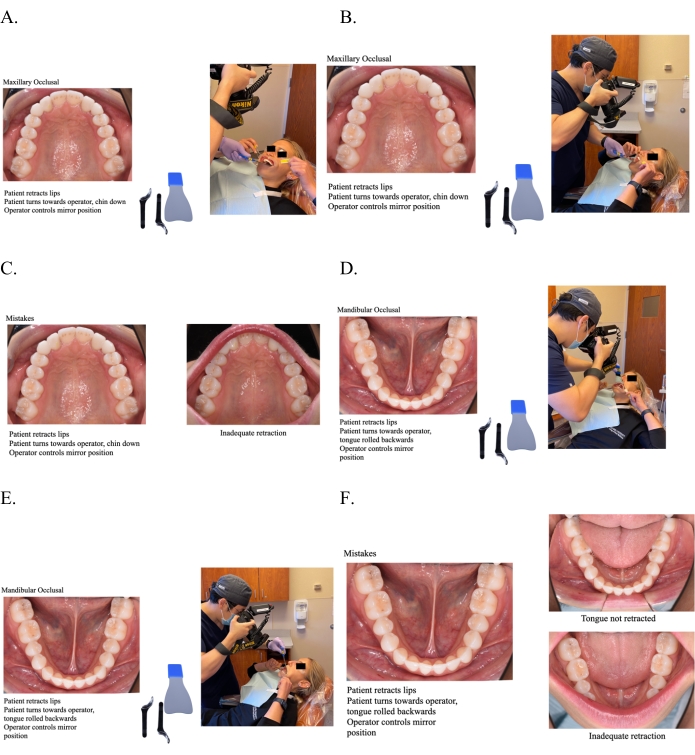 Video: A Standardized Approach to Extra-Oral and Intra-Oral Digital ...