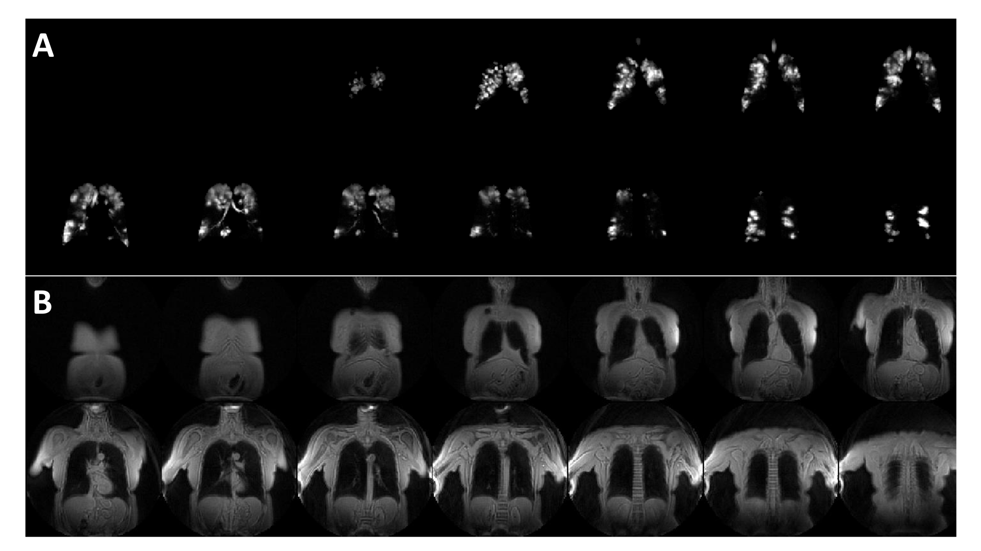 Acquiring Hyperpolarized 129Xe Magnetic Resonance Images of Lung ...