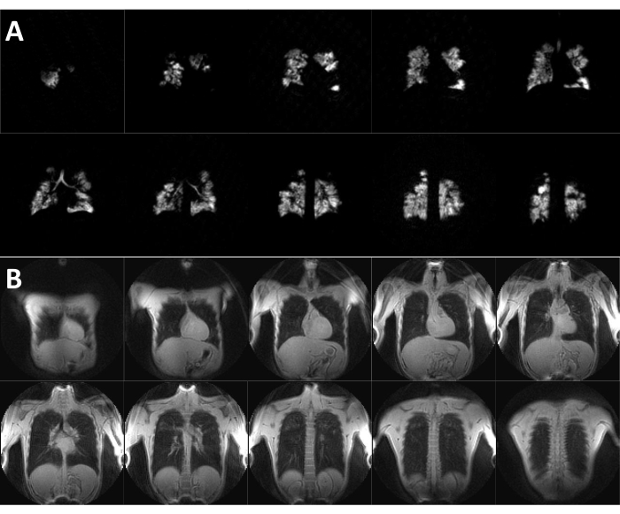 Acquiring Hyperpolarized 129Xe Magnetic Resonance Images of Lung ...