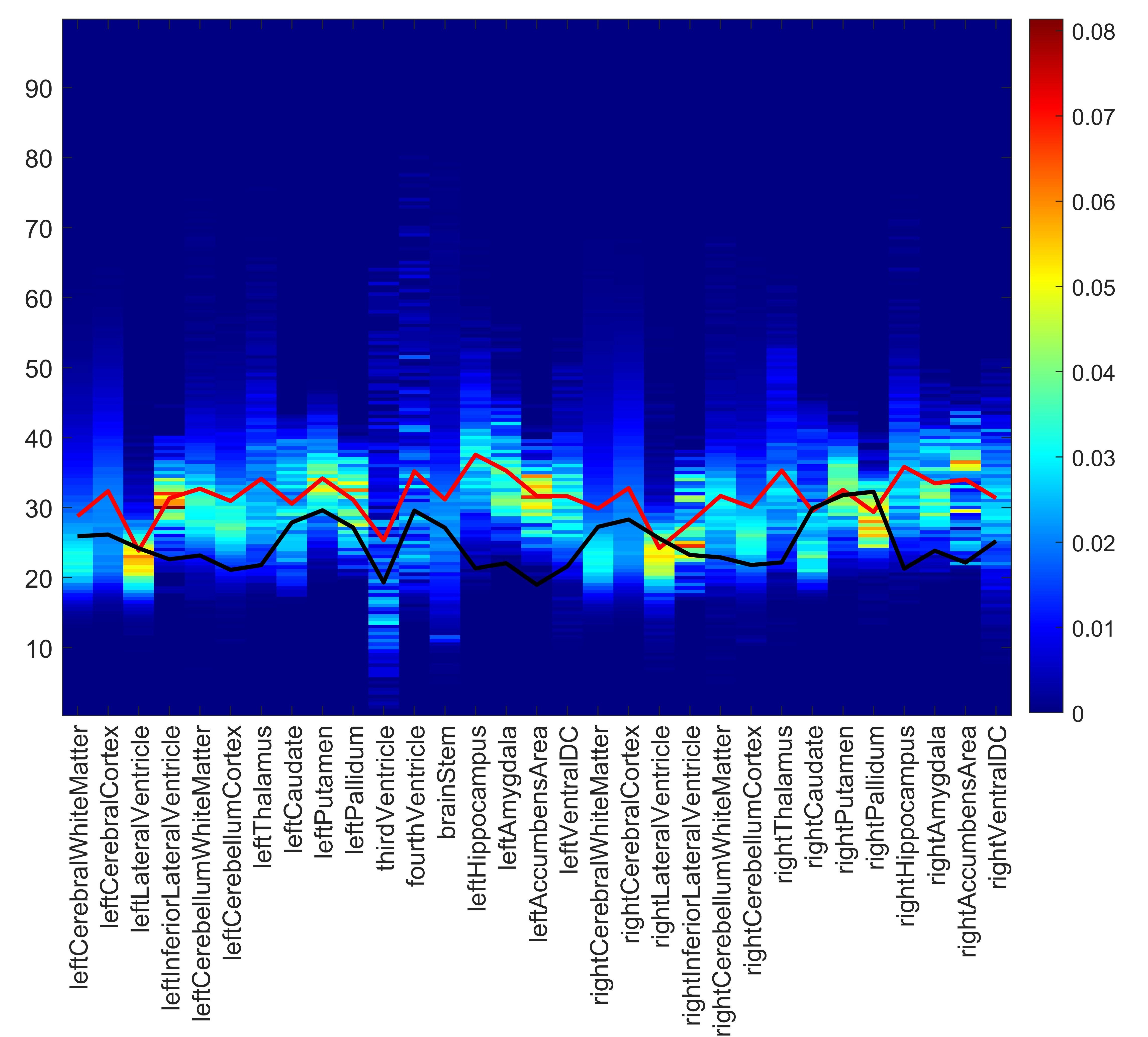 Construction and Application of Cerebral Functional Region-Based ...