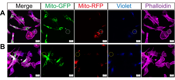 Mitochondrial Transfer Via Tunneling Nanotubes Between Mesenchymal Stem ...