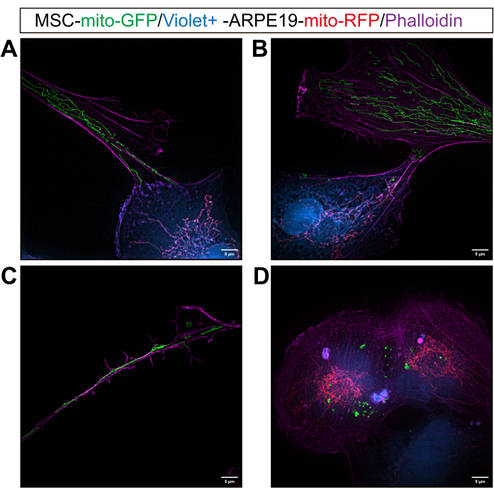 Mitochondrial Transfer Via Tunneling Nanotubes Between Mesenchymal Stem ...
