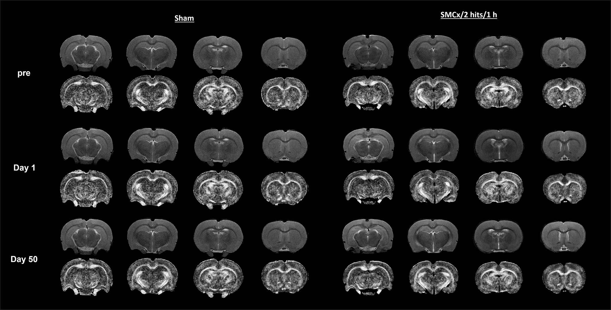 Video: Development of an Uncomplicated Mild Traumatic Brain Injury ...
