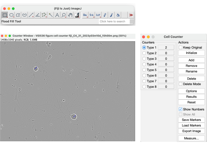 Standardization of a Novel Semi-Automatic Software for Neurite ...