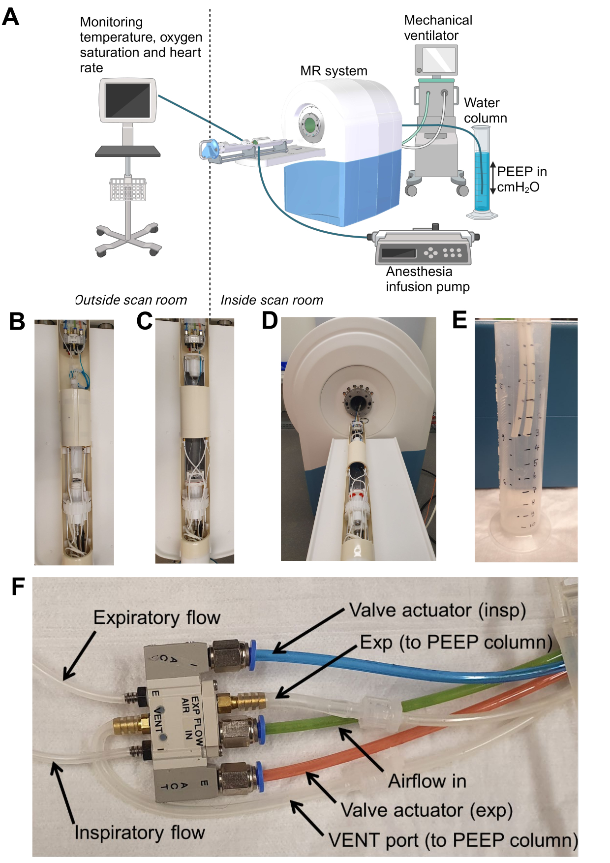 Video: 3D Cine Magnetic Resonance Imaging of Respiratory Motion in ...
