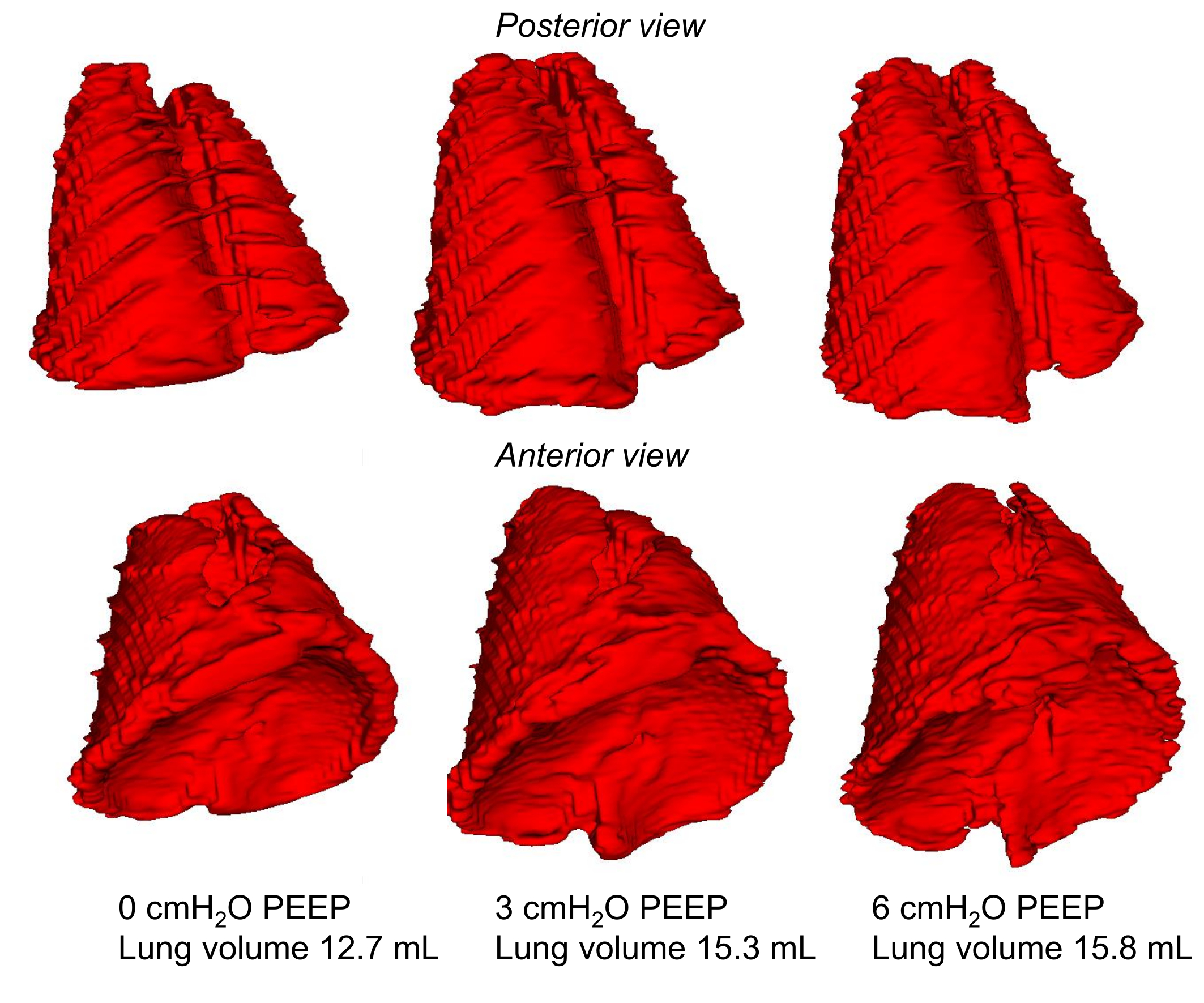 Video: 3D Cine Magnetic Resonance Imaging of Respiratory Motion in ...