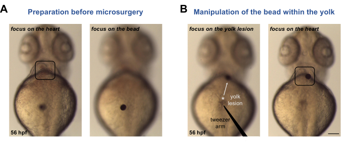 Manipulating Mechanical Forces in the Developing Zebrafish Heart Using ...