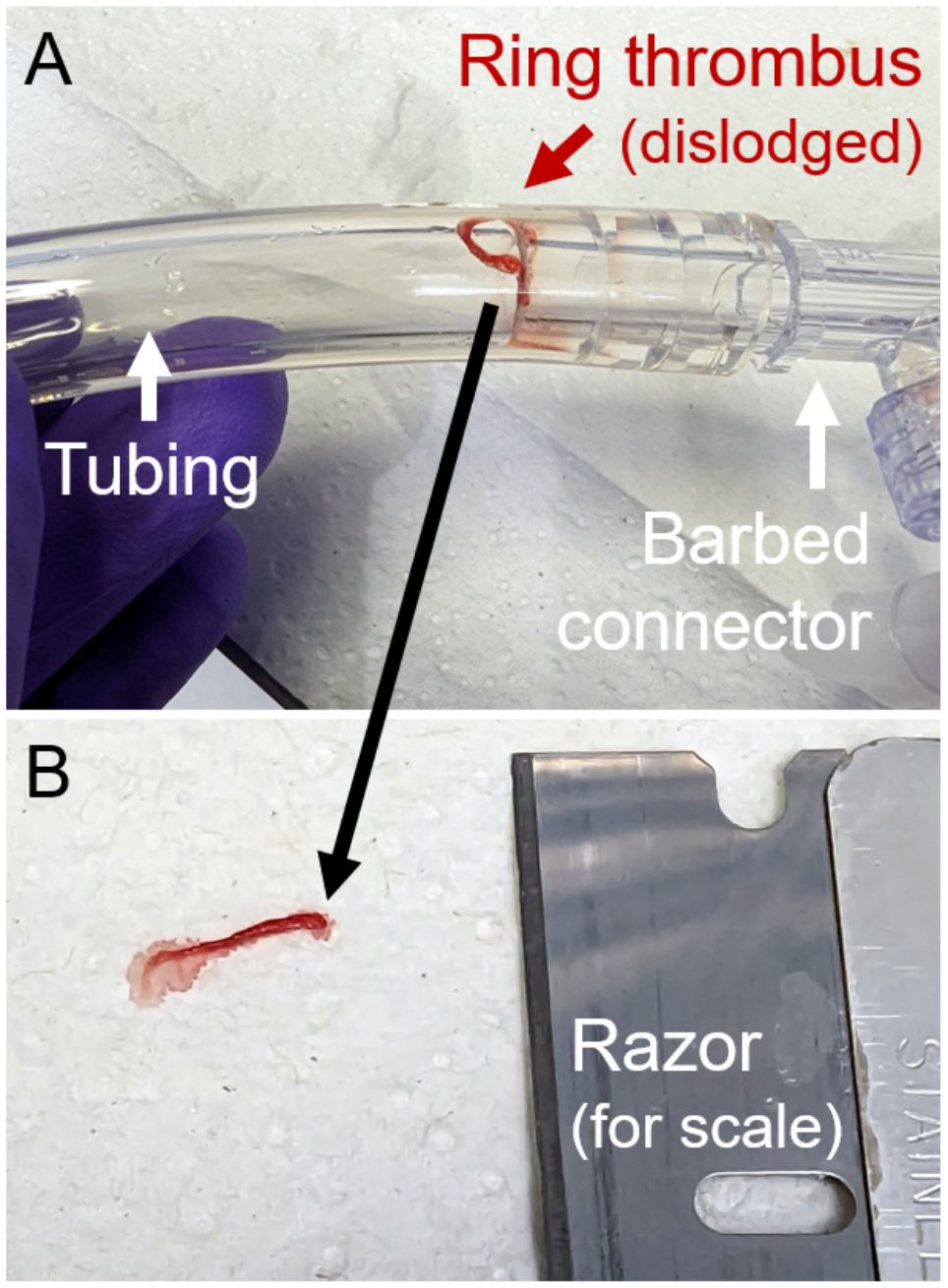 In Vitro Thrombosis Test for Ventricular Assist Devices