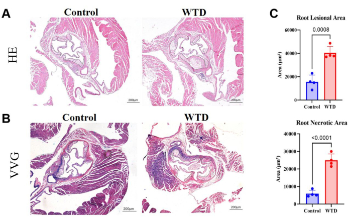 Isolation and Analysis of Aortic Arch and Root Lesions in an ...