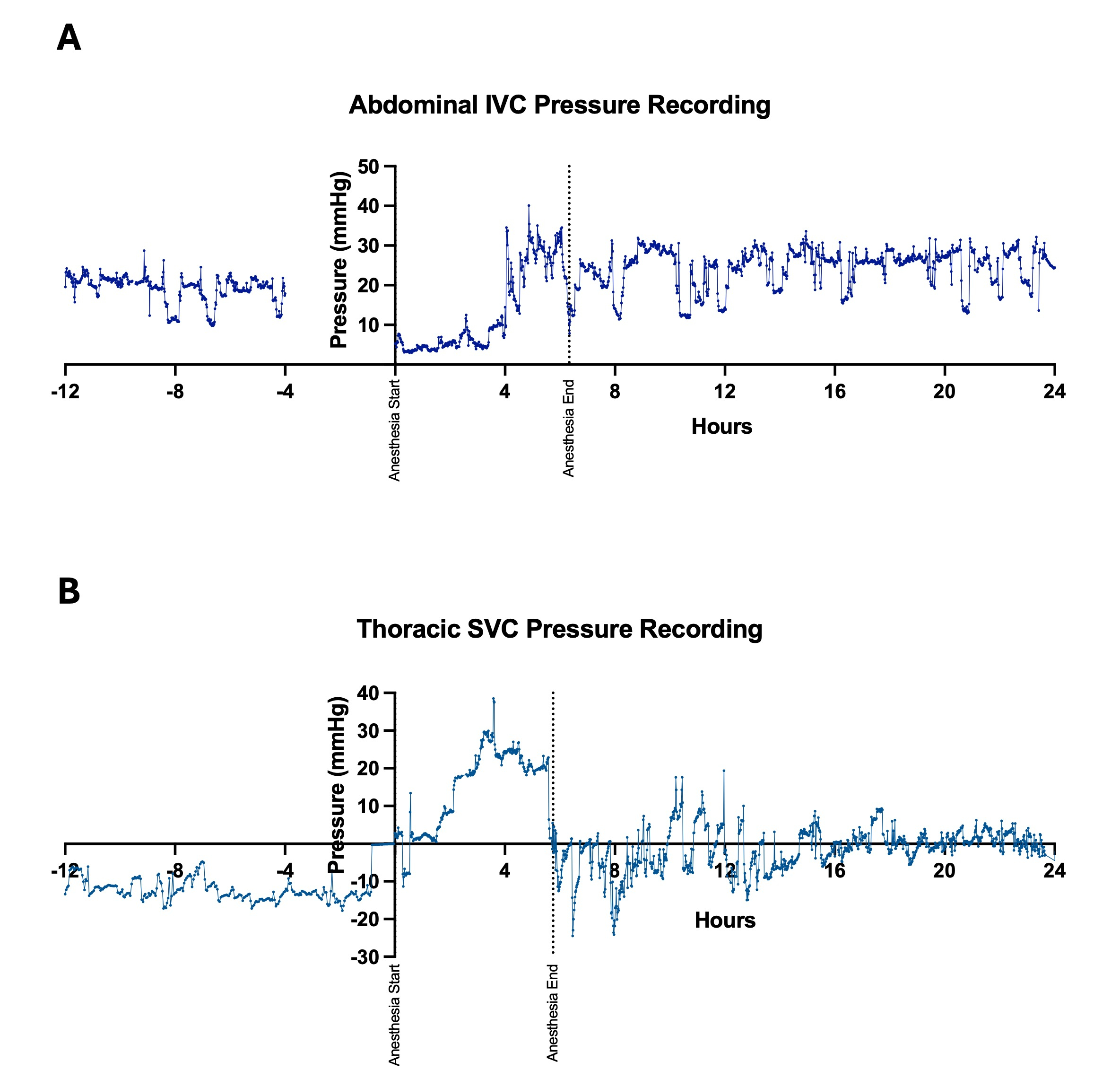 Wireless Telemetry Device Implantation in a Fontan Ovine Model for ...