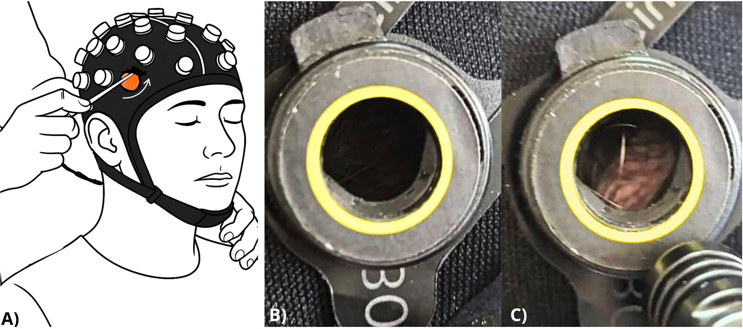Video: Resting-State Connectivity and Neuroimaging of Prefrontal Cortex ...