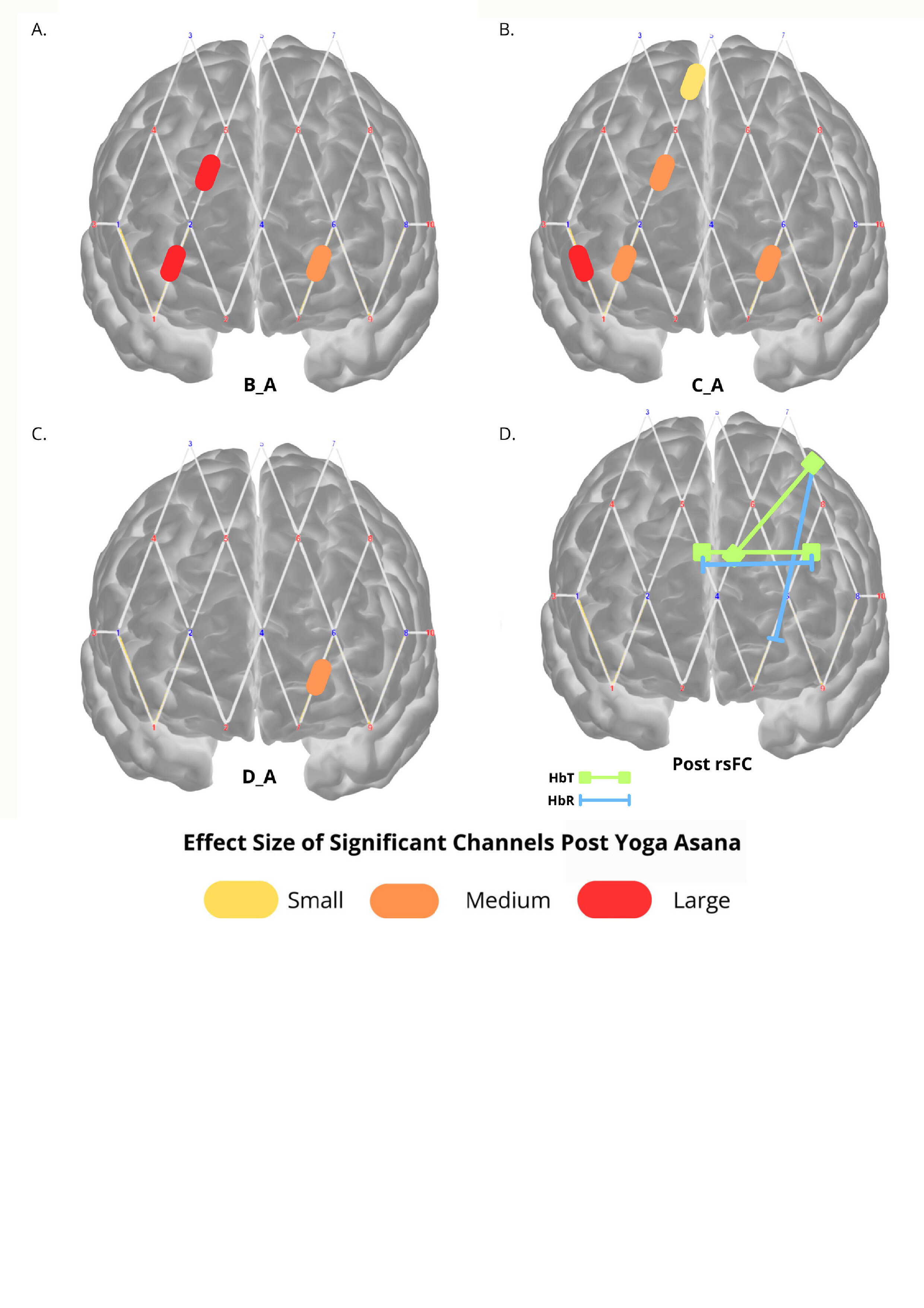 Video: Resting-State Connectivity and Neuroimaging of Prefrontal Cortex ...
