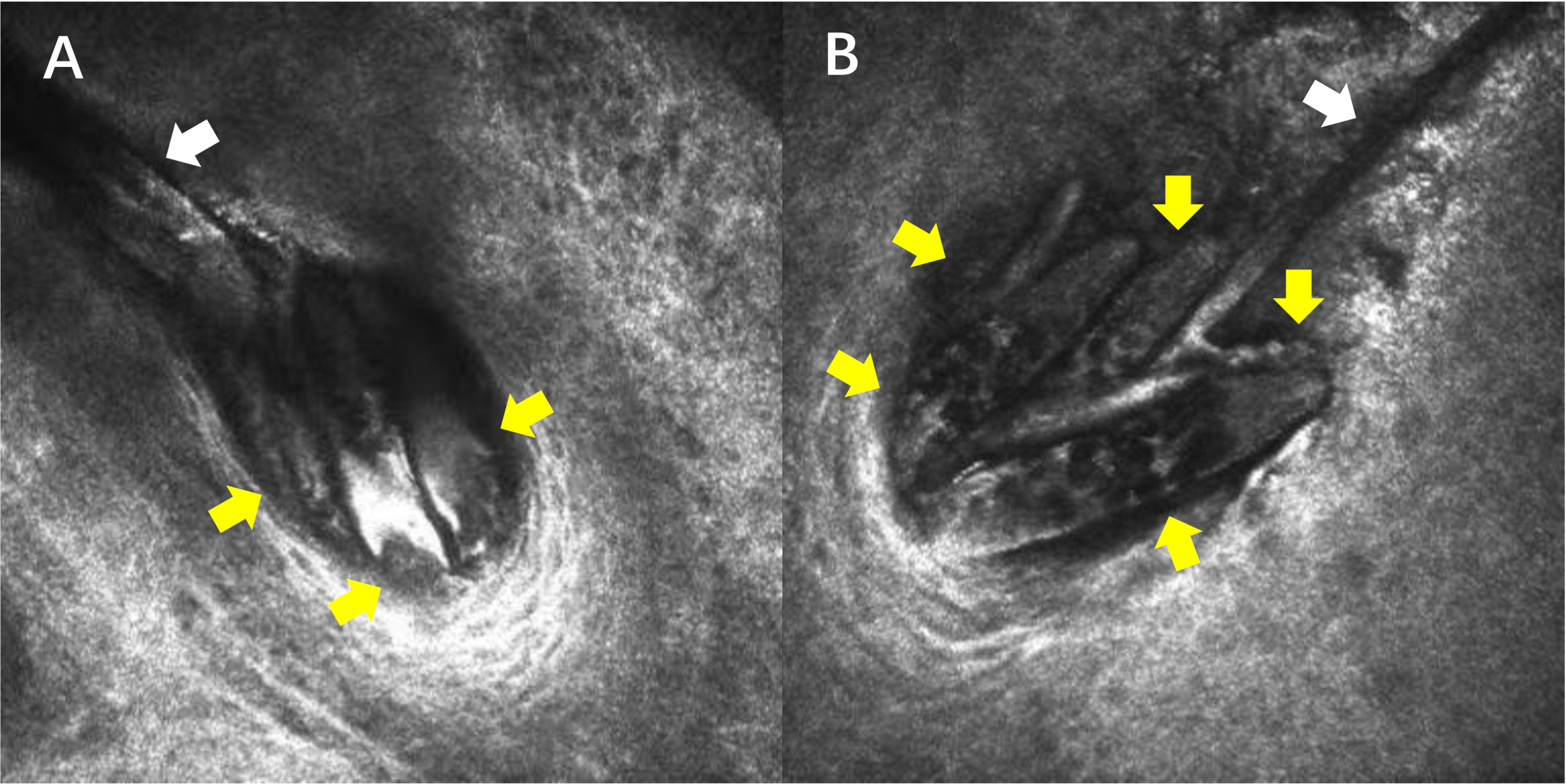 In Vivo Confocal Microscopy: A Standard Operating Procedure for the ...