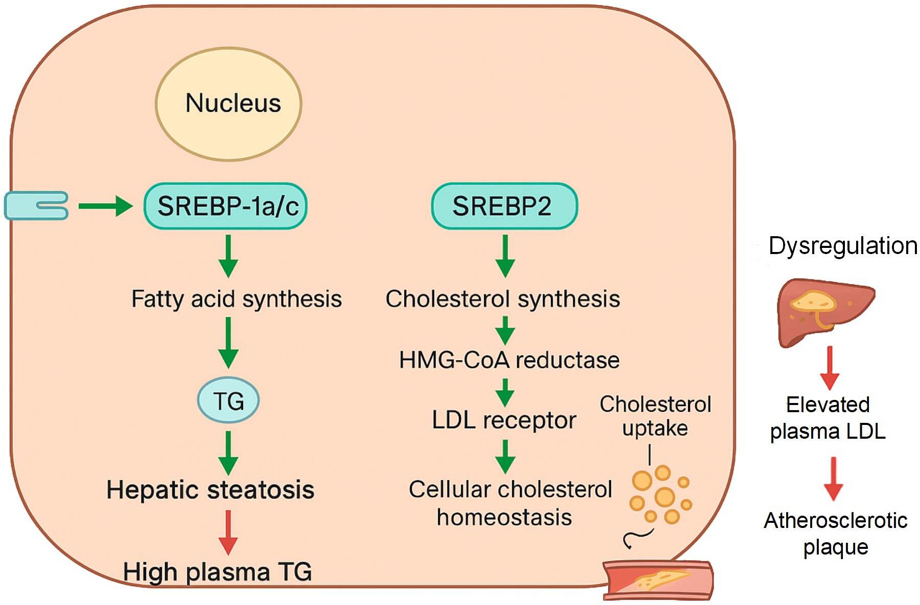 Precision Management of Dyslipidemia in Atherosclerosis: Mechanisms ...
